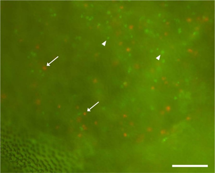 See-through observation of malaria parasite behaviors in the mosquito ...