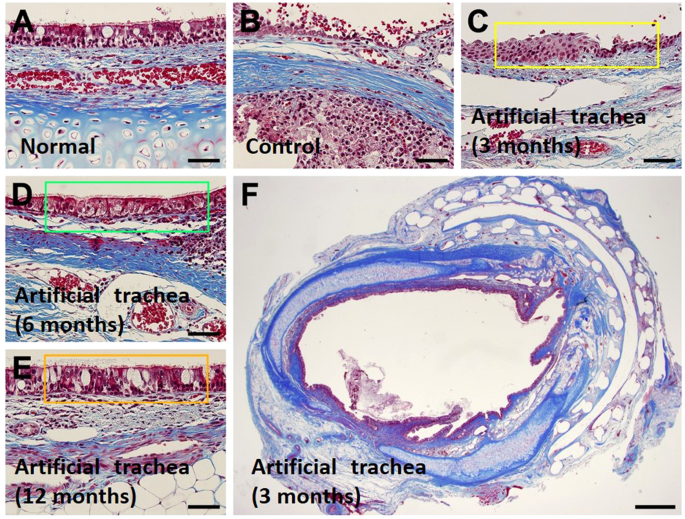 Experimental Tracheal Replacement Using 3-dimensional Bioprinted ...