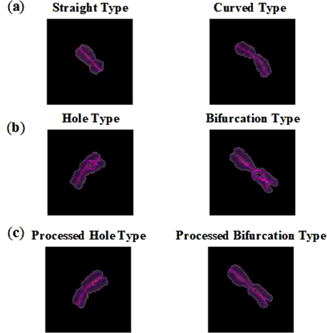 A dicentric chromosome identification method based on clustering and ...