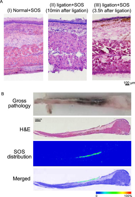 A thin layer of sucrose octasulfate protects the oesophageal mucosal ...