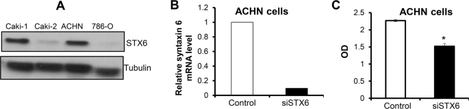 Syntaxin 6: A novel predictive and prognostic biomarker in papillary ...