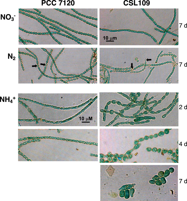 ZipN is an essential FtsZ membrane tether and contributes to the septal ...