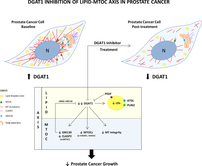 DGAT1 Inhibitor Suppresses Prostate Tumor Growth and Migration by ...