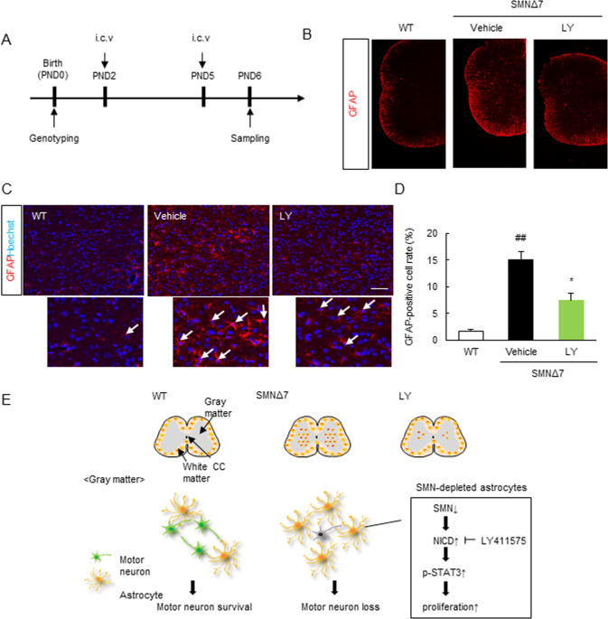 Notch Signaling Mediates Astrocyte Abnormality in Spinal Muscular ...