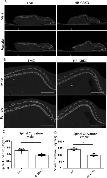 Ablation of glucocorticoid receptor in the hindbrain of the mouse ...