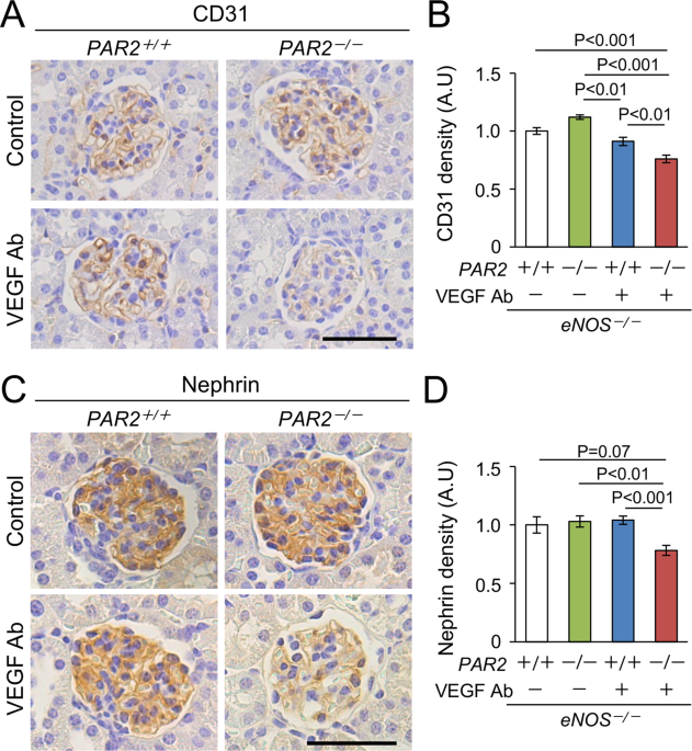 Protease-activated receptor 2 protects against VEGF inhibitor-induced ...