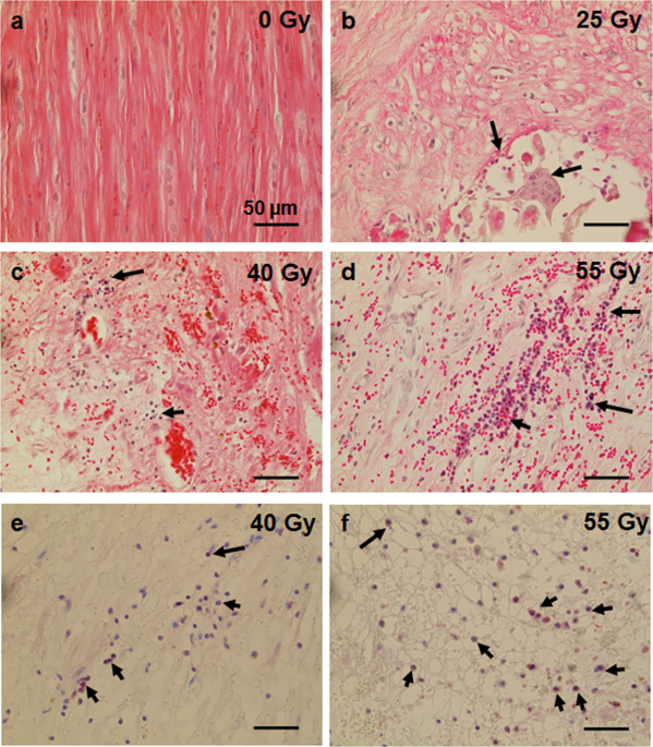 Biological Cardiac Tissue Effects of High-Energy Heavy Ions ...