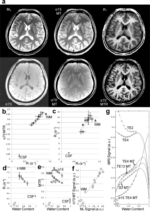Magnetic resonance imaging of brain cell water | Scientific Reports