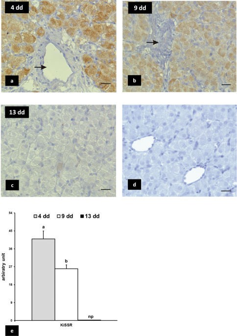 Kisspeptin/kisspeptin receptor system in pseudopregnant rabbit corpora ...