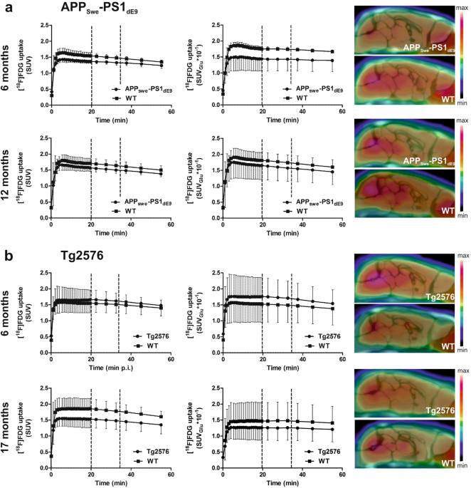 Effect of genotype and age on cerebral [ 18 F]FDG uptake varies between ...