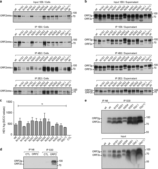New insights into the ORF2 capsid protein, a key player of the ...