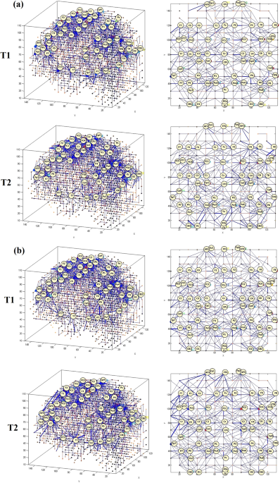 Spiking Neural Network Modelling Approach Reveals How Mindfulness ...