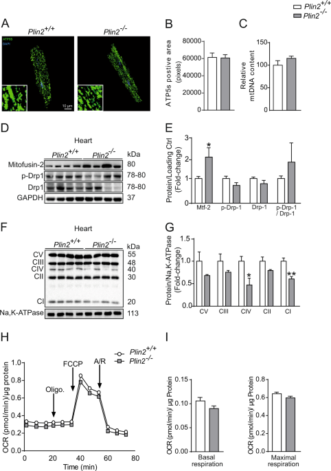 Plin2-deficiency reduces lipophagy and results in increased lipid ...