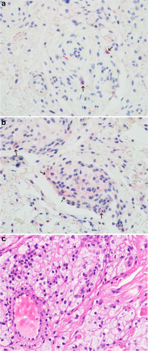 Galanin is a potent modulator of cytokine and chemokine expression in ...