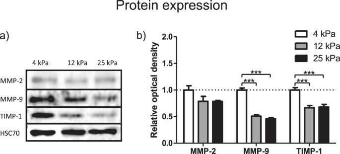 Matrix stiffness modulates the activity of MMP-9 and TIMP-1 in hepatic ...