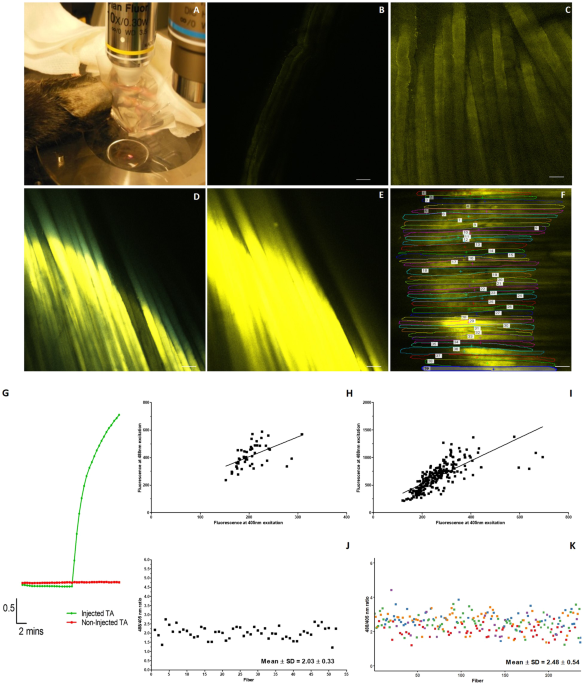 HyPer2 imaging reveals temporal and heterogeneous hydrogen peroxide ...