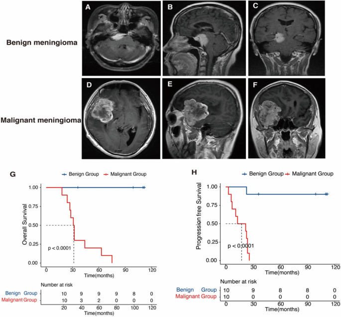 Prognostic factors and Doxorubicin involved in malignant progression of ...