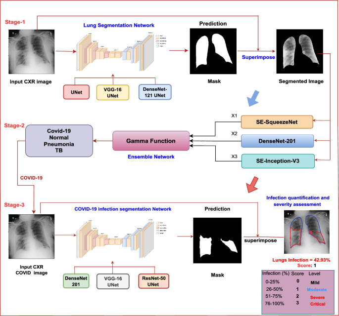 A multistage framework for respiratory disease detection and assessing ...