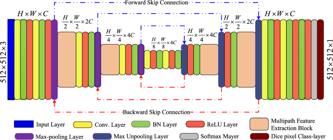 LMBiS-Net: A lightweight bidirectional skip connection based multipath ...