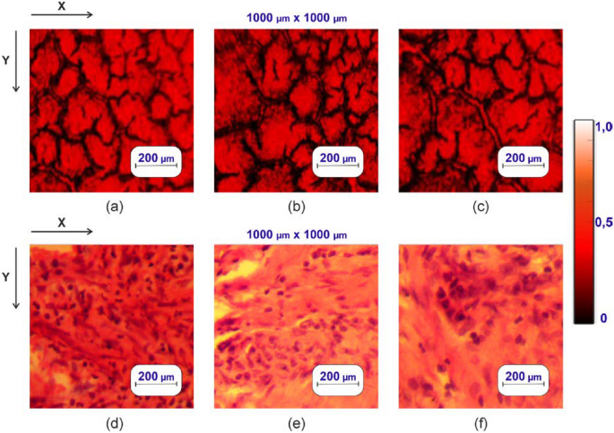 Insights into polycrystalline microstructure of blood films with 3D Mueller matrix imaging ...