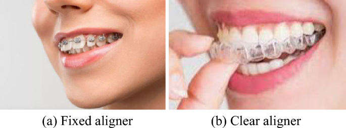 Research on path planning for clear aligner flexible manufacturing ...