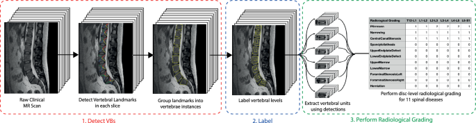 Automated detection, labelling and radiological grading of clinical ...