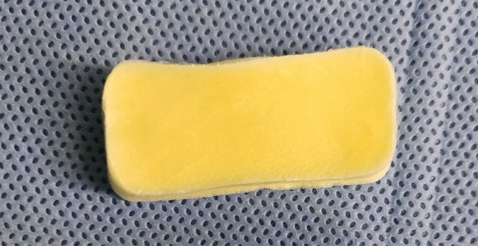 Safety and effectiveness of a drug-loaded haemostatic sponge in chronic ...