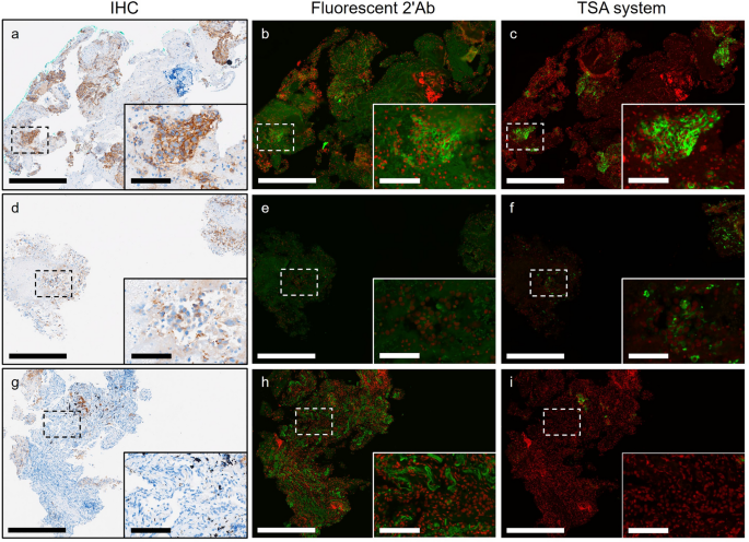 Optimizing immunofluorescence with high-dynamic-range imaging to enhance PD-L1 expression ...