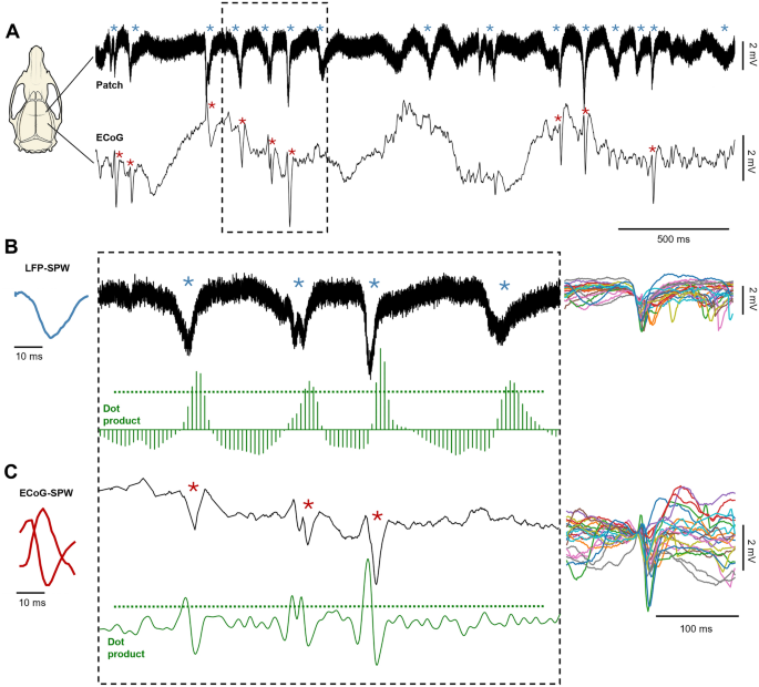 Local field potential sharp waves with diversified impact on cortical ...