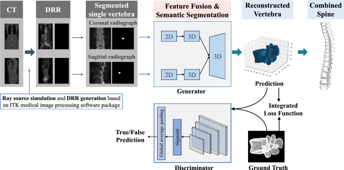 Automatic 3D reconstruction of vertebrae from orthogonal bi-planar ...