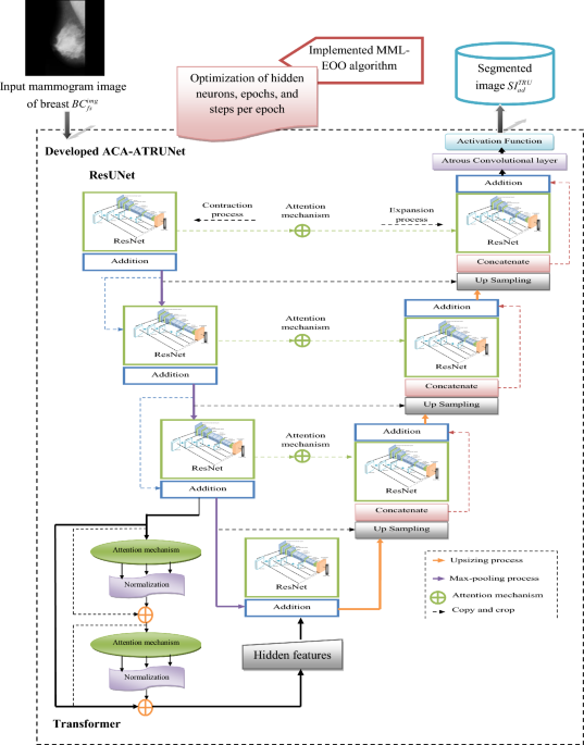 Intelligent breast cancer diagnosis with two-stage using mammogram ...