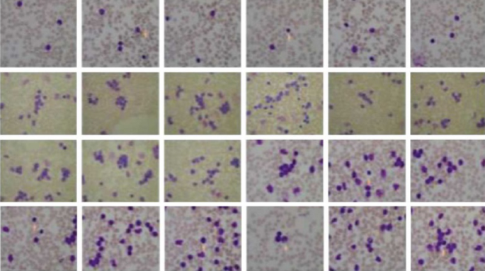 Modified osprey algorithm for optimizing capsule neural network in leukemia image recognition ...