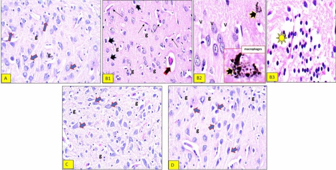 Unveiling Lobophytum sp. the neuroprotective potential of Parkinson's ...
