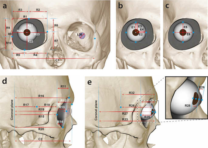 Developing an eyeball positioning method in the eye orbit for ...