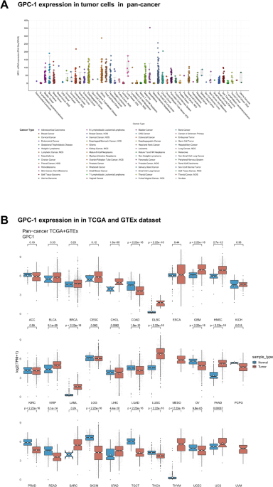 Pan-cancer analysis and the oncogenic role of Glypican 1 in ...