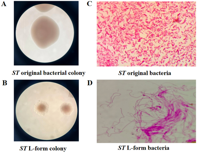 Salmonella Under Microscope
