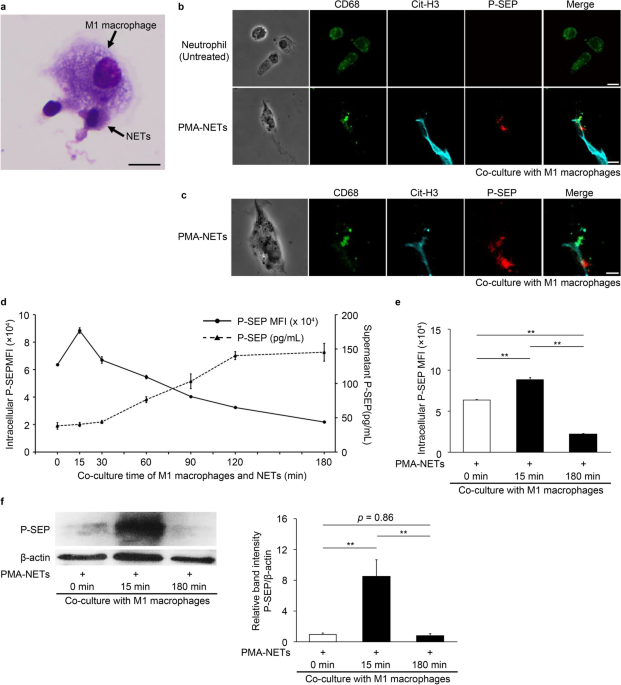 Identification of organs of origin of macrophages that produce ...