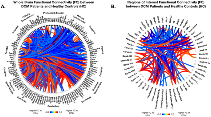 Sex Specific Alterations In Functional Connectivity And Network