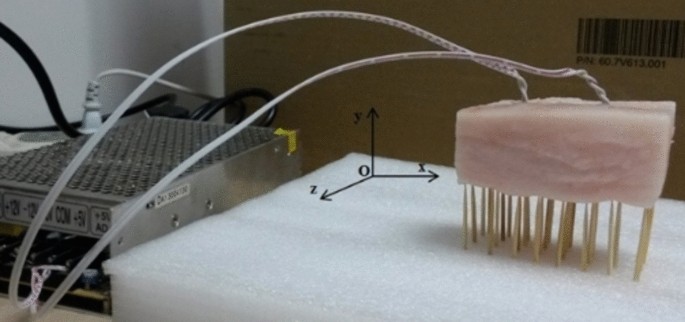 Noninvasive reconstruction of internal heat source in biological tissue ...