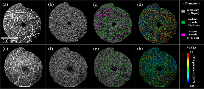 Developing quantitative analysis program of blood flow velocity ...