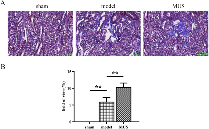 MSU crystallization promotes fibroblast proliferation and renal ...