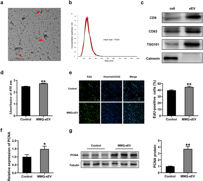 Pituitary-derived small extracellular vesicles promote liver repair by ...