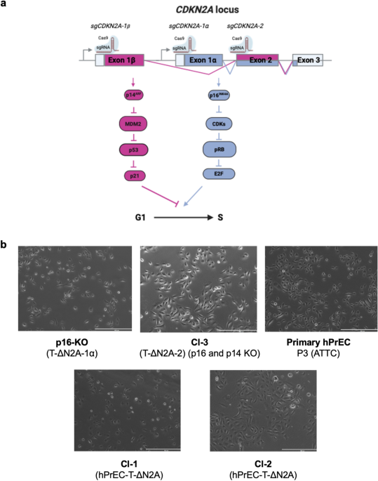 Derivation of human primary prostate epithelial cell lines by differentially targeting the ...