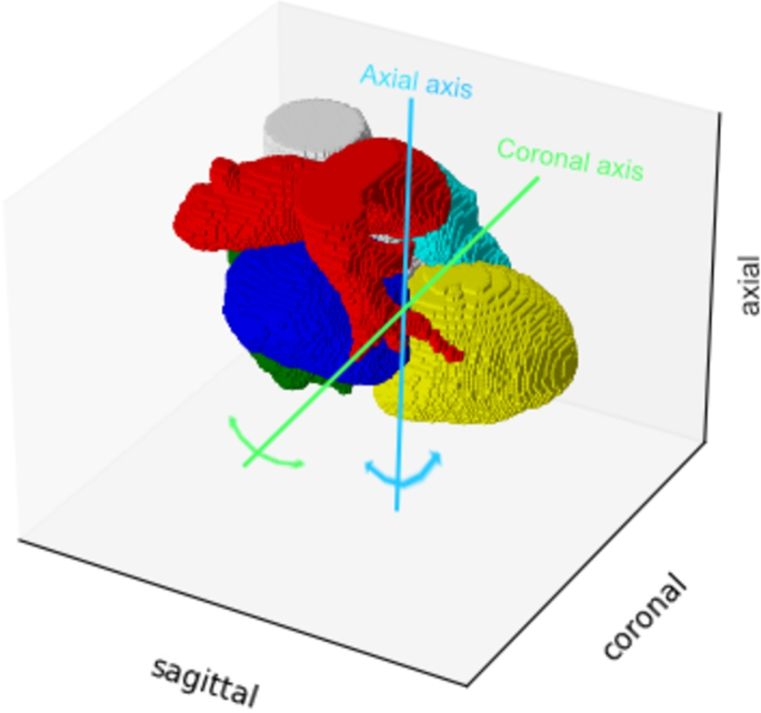 3D augmentation for volumetric whole heart segmentation | Scientific ...