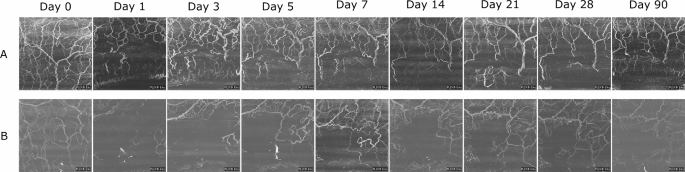 Impact of scleral cautery on limbal vasculature after cataract surgery ...