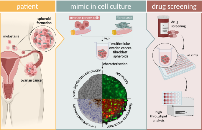 Multicellular ovarian cancer spheroids: novel 3D model to mimic tumour ...