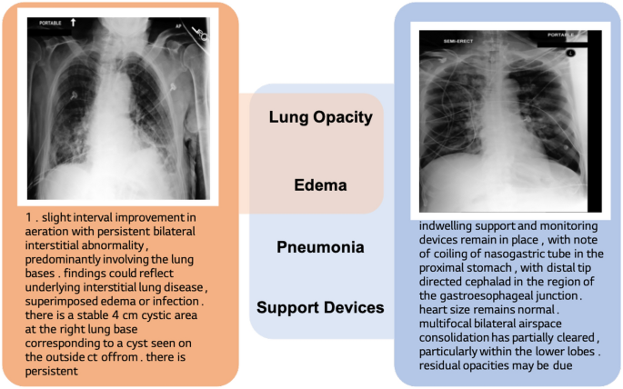 Significantly improving zero-shot X-ray pathology classification via ...