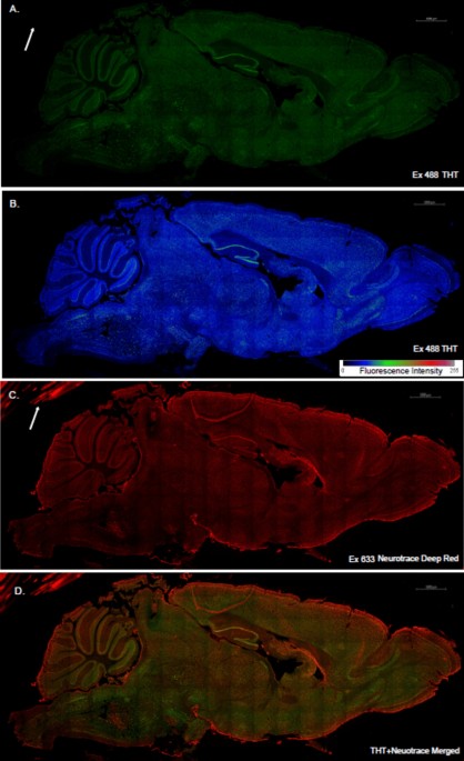 Thioflavin-T: application as a neuronal body and nucleolar stain and ...