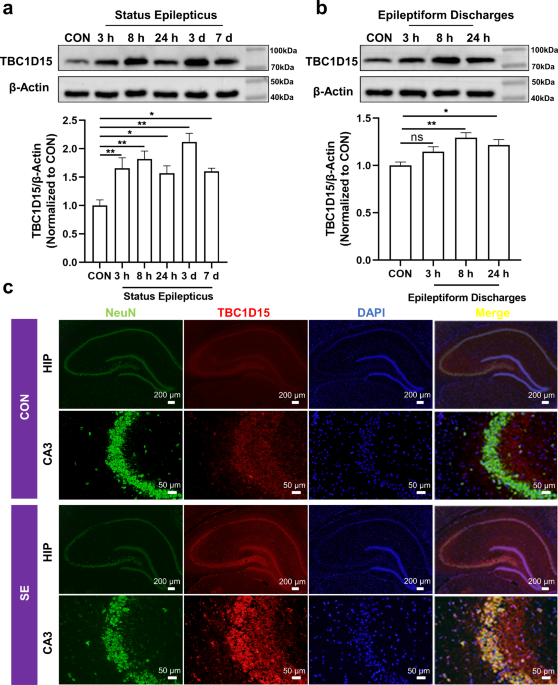 TBC1D15-regulated mitochondria–lysosome membrane contact exerts ...