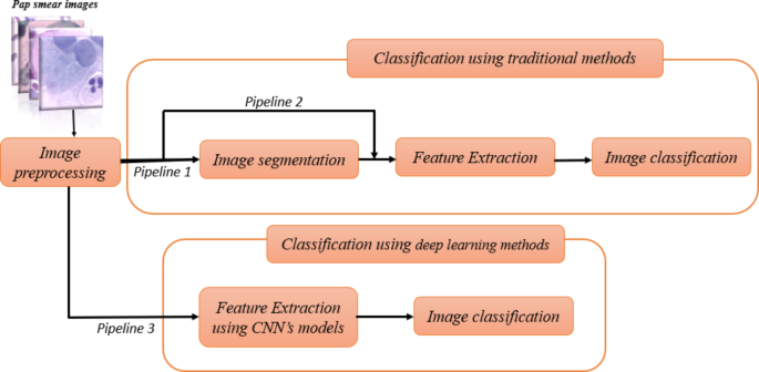 Comparison of deep transfer learning models for classification of ...